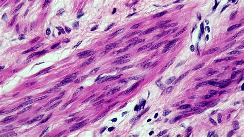 Smooth Muscle Slide 400x