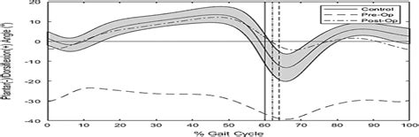 Journal Of Pediatric Orthopaedics