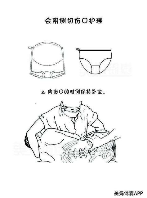 產婦的尿常常呼之不出，以及側切產婦的會陰護理 每日頭條