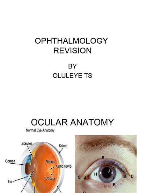 Ophthalmology Companion Pdf Glaucoma Ischemia