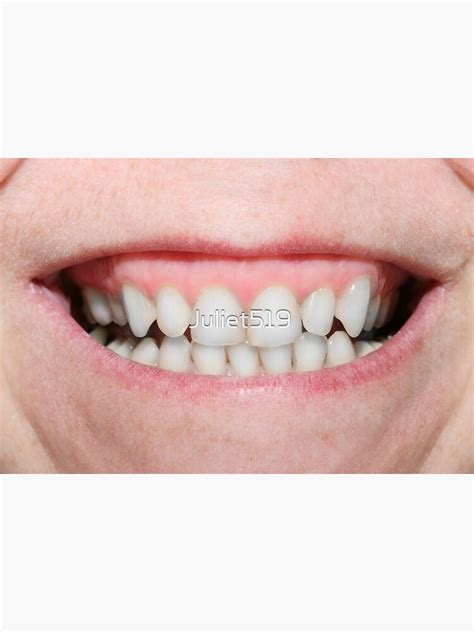 Funny Toothy Grin Mask Sticker For Sale By Juliet519 Redbubble