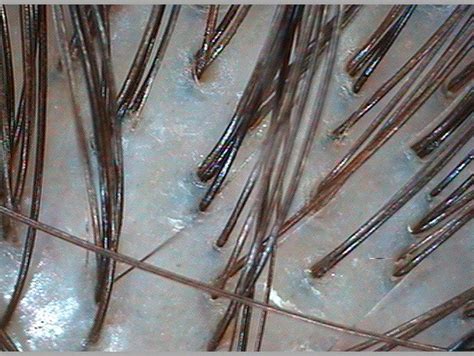 Trichology Martine Langsam Iat