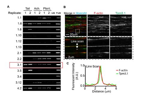 Tpm Isoform Expression Is Dependent On Tendon Type But All Three Types