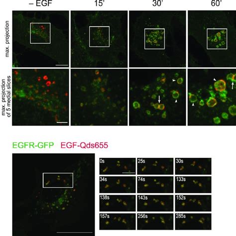 Localization Of Eea1 Protein On Endosomes Of Pae A11 Cells Expressing