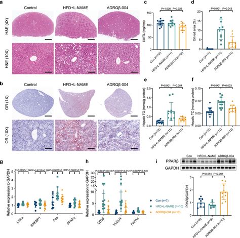 Adrqβ 004 Vaccine Alleviated Hepatic Steatosis Elicited By Hfd