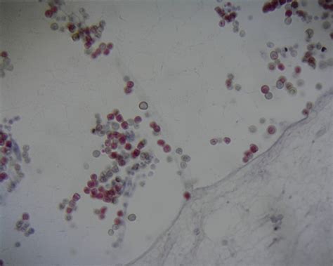Penicillium Section With Hyphae And Eduspace Supplies