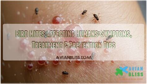 Bird Mites Affecting Humans Symptoms Treatment And Prevention Tips