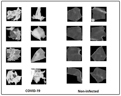Extracted Superpixels Download Scientific Diagram