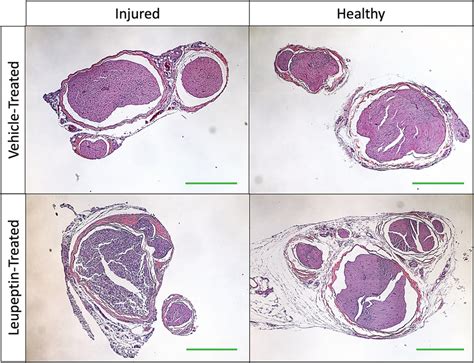 5 μm Cross‐sections Of Injured And Contralateral Healthy Sciatic Nerve