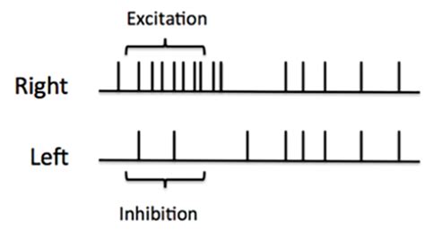 Update On The Development Of An Implantable Vestibular Prosthesis Ent