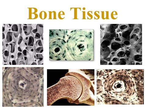Bone Tissue