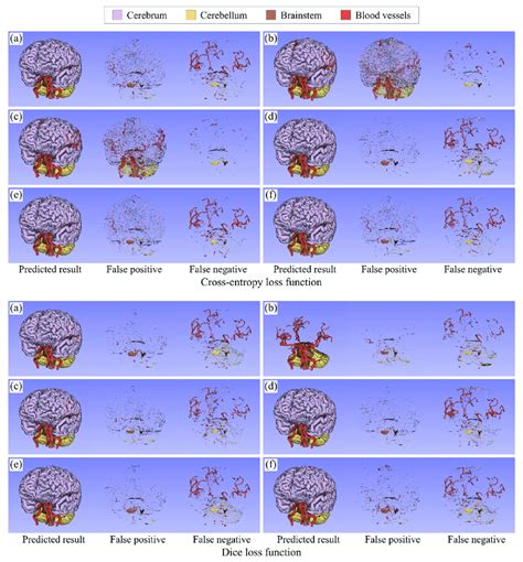 visualization of the segmentation results in the five class