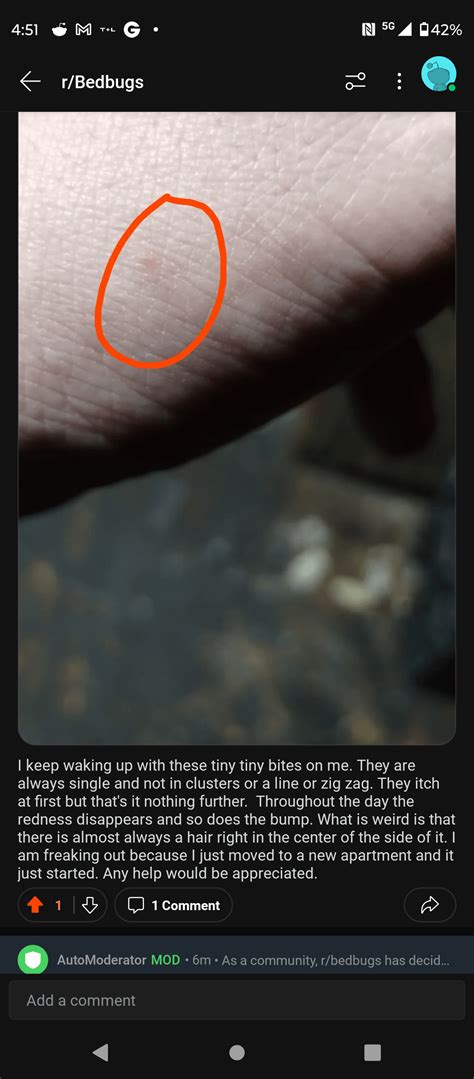 Bed Bug Bites R Bugbites