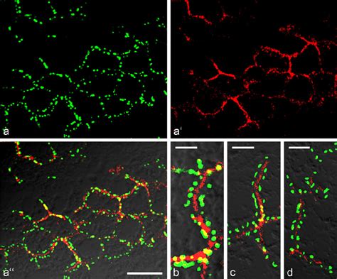 Confocal Laser Scanning Double Label Immunofluorescence Microscopy Of