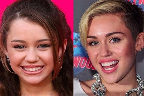Miley Cyrus Teeth Transformation From Imperfect To Iconic Dent X