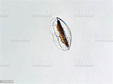 Amphora Sp Ganggang Di Bawah Tampilan Mikroskopis Foto Stok Unduh Gambar Sekarang Alga