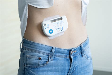 ACCELERATING DEVELOPMENT OF SUBCUTANEOUS DELIVERY OF LARGE VOLUME BIOLOGICS ONdrugDelivery