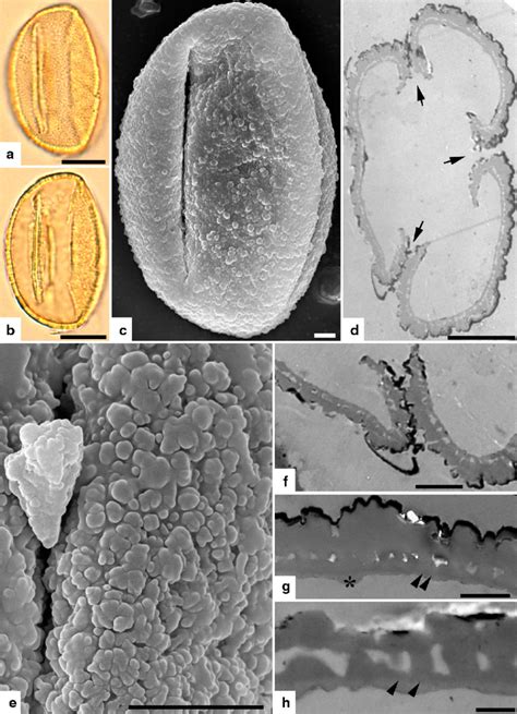 Pollen Morphology And Ultrastructure Of Group 5 Ah A B Lm