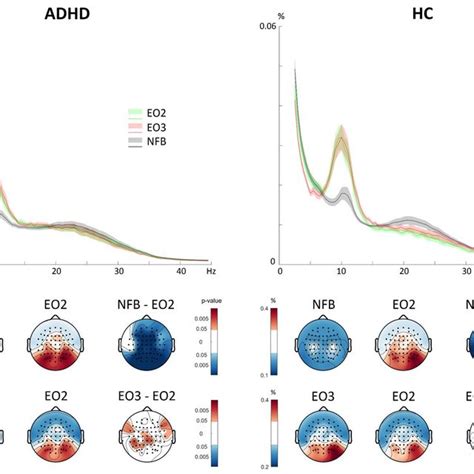 Top Eeg Relative Power Spectrum During Cpt1 Green And Cpt2 Red In Download Scientific