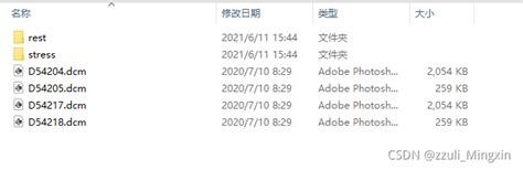 Java提取dicom文件中的多张图片，并进行放大、取反处理java Dicom图浏览修改 Csdn博客