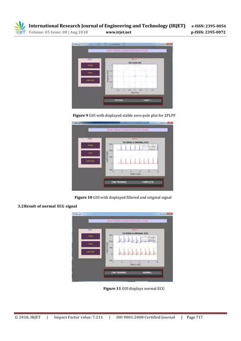 Irjet Arrhythmia Detection Using One Dimensional Convolutional Neural
