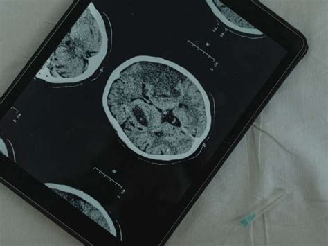 What Is A Monochrome Camera Supertek