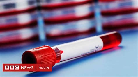 Coronavirus Treatment Immune Sign Dey Give Beta Hope Say Covid 19 Fit