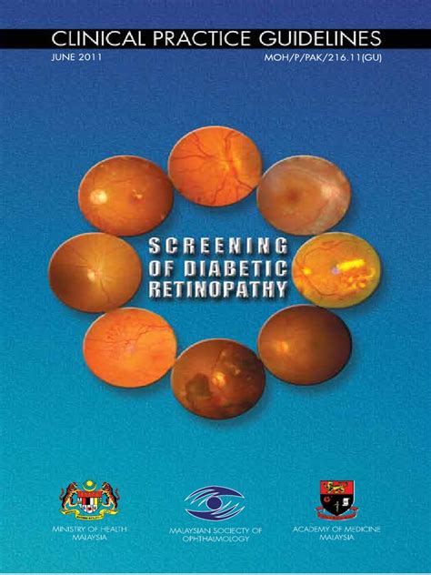 Screening Of Diabetic Retinopath 6601 Pdf Evidence Based Medicine