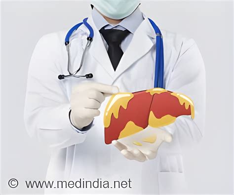 Health Ministry Launches New Guidelines For Non Alcoholic Fatty Liver Disease