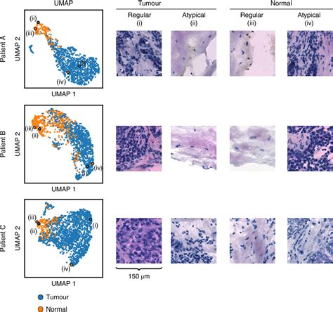 Figure 4 From Integrating Spatial Gene Expression And Breast Tumour Morphology Via Deep Learning