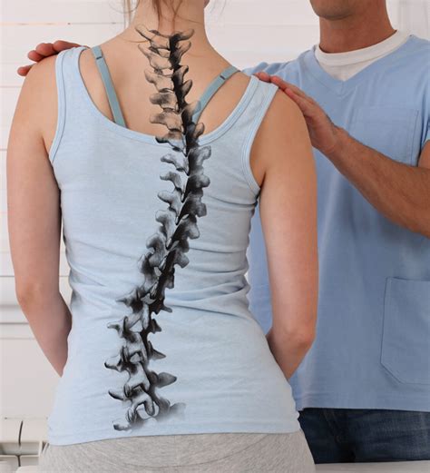 Scroth Terapi Fizyo Yoga