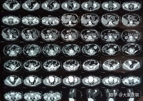 Ct、核磁、b超的区别，讲的太到位了 知乎