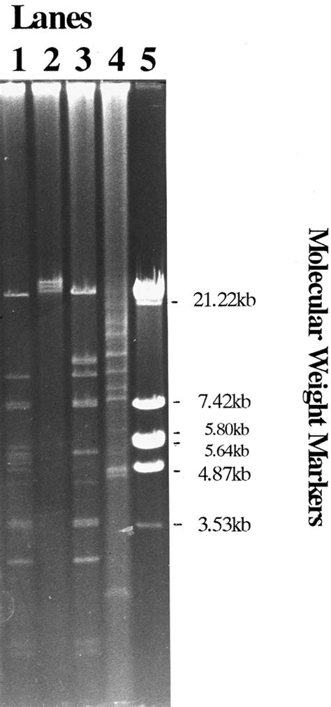 Restriction Analysis Of R391 For The Restriction Enzymes Ecori And