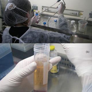 A B Sequence Of Images Showing The Separation Of Mononuclear Cells Download Scientific