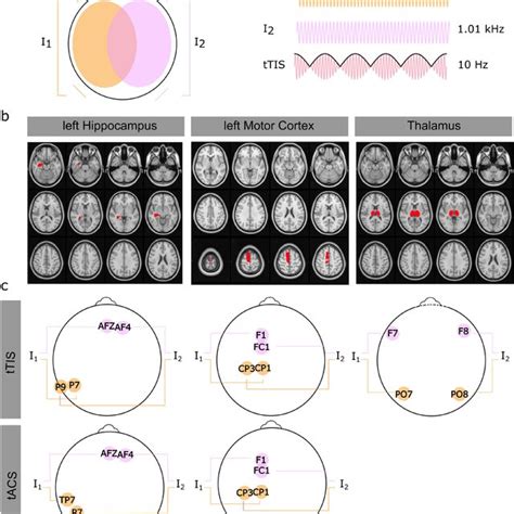 Concept Of Temporal Interference Stimulation Ttis And Selected Download Scientific Diagram