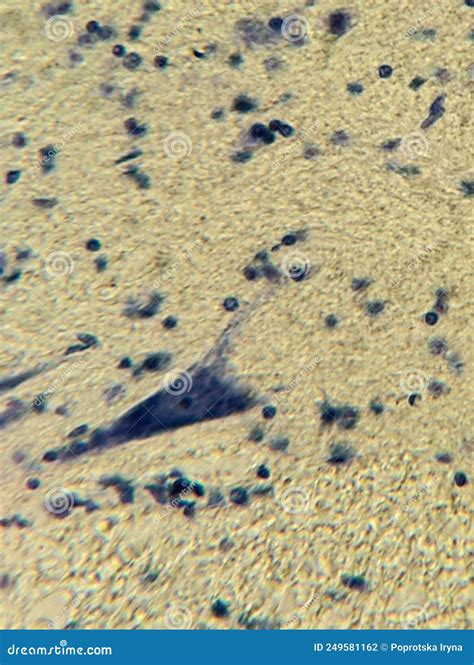 Neurocytes With Processes Cell Structure Of Nervous Tissue Stock Image