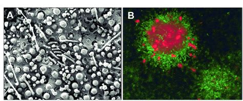 Biofilms A The Scanning Electron Microscopy Sem Image Shows A
