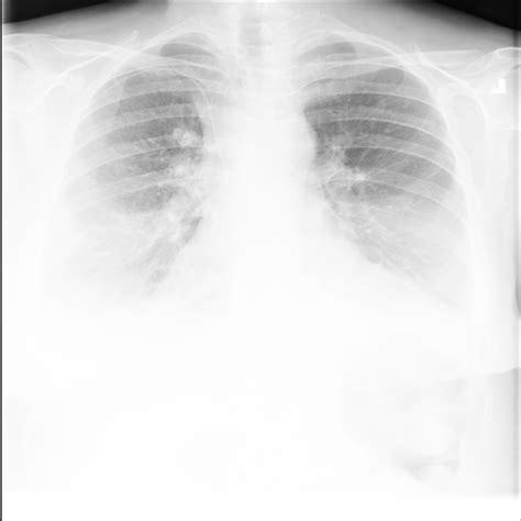 object detection object detection 8gv3b roboflow universe