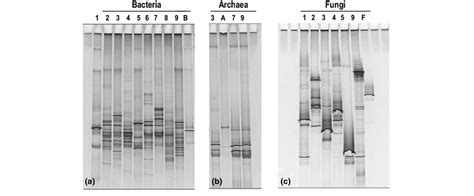 Dgge Fingerprints Derived From A Bacterial B Archaeal And C Download Scientific Diagram