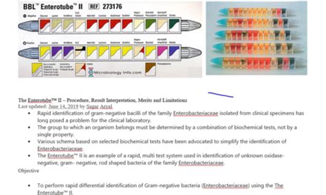 10 16 Micro Lab Quiz Flashcards Quizlet
