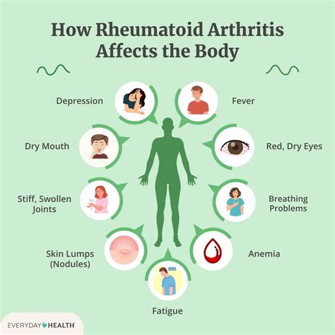 Rheumatoid Arthritis Symptoms You Shouldnt Ignore Everyday Health