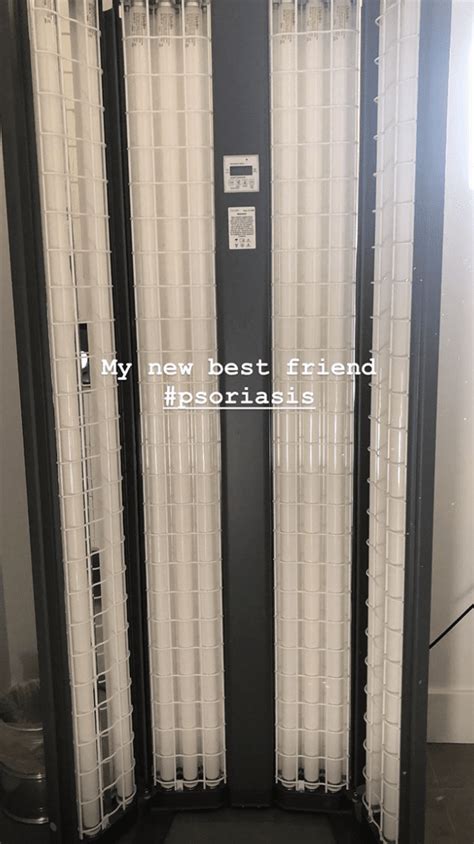 Kim Kardashian Shares Selfie Using An Herbal Ointment To Fight The Psoriasis On Her Face