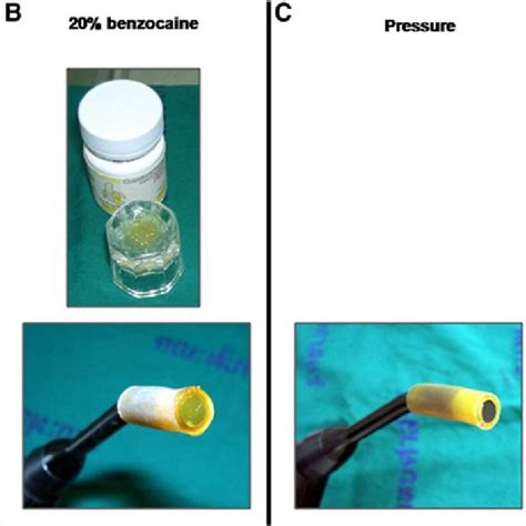 The Customized Laser Probe For Each Group A The Low Intensitiy Laser Download Scientific