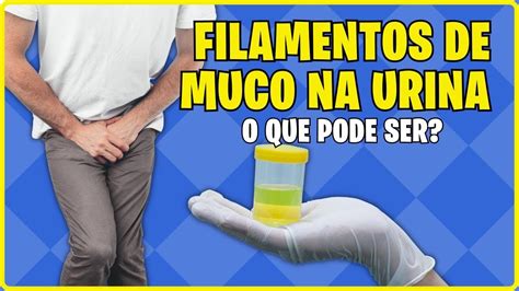 O Que Significa Filamento De Muco Na Urina Librain