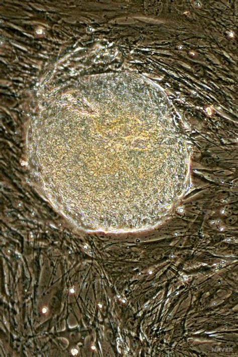 배아줄기세포 성체줄기세포 네이버 블로그