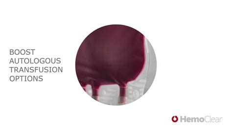 Video Willem Van Prooijen Mpm Posted On Linkedin