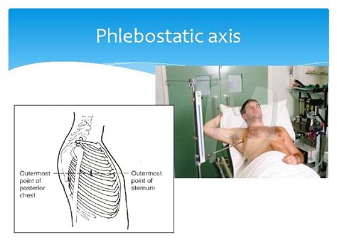 Central Venous Catheters Arterial Lines Abg Sampling Anatomy