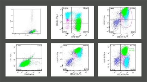 Heres An Interesting Lymph Node Case From My Lab The Lime Green Cells Are Positive For Cd3
