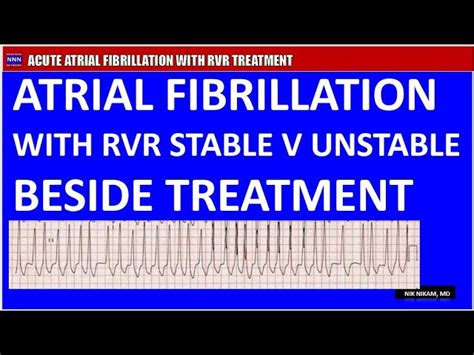 Afib With Rvr Treatment