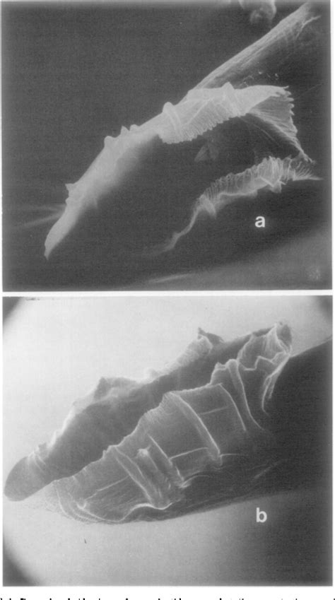 Figure 5 From Development Of The Male Reproductive System And Sexual